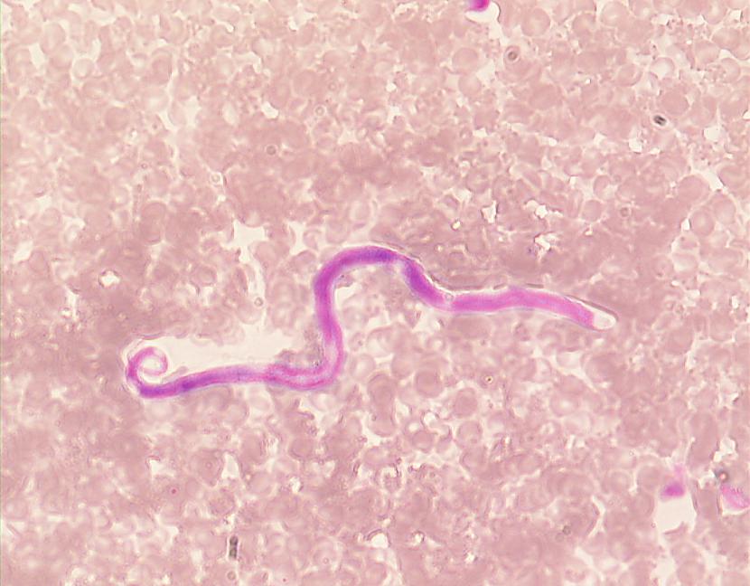 Interesanti Fakti Par PARAZĪTIEM 2.daļa. - Spoki
